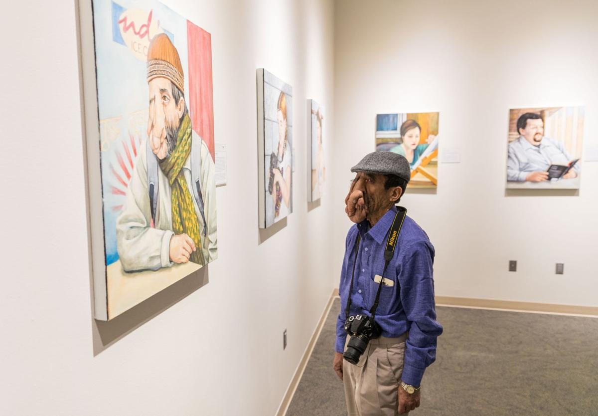 Nebraska Nepalese Society NNS Disfigured Nepali Man In U S For nebraska-nepalese-society-nns-disfigured-nepali-man-in-u-s-for